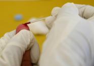 China 14 Infected With HIV Hepatitis B As Hospital Staff Reuse
