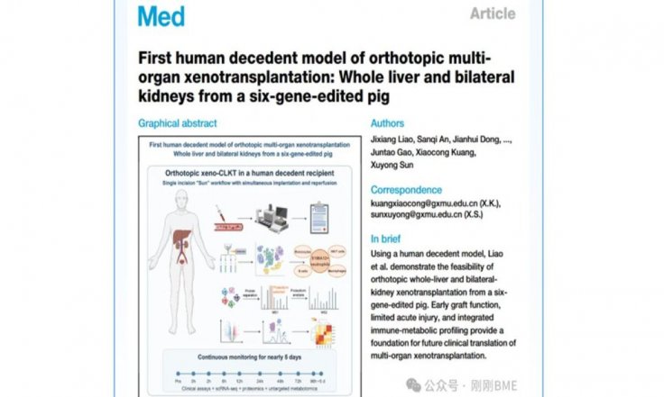 China Performs World's First Pig Liver and Kidney Transplant I...